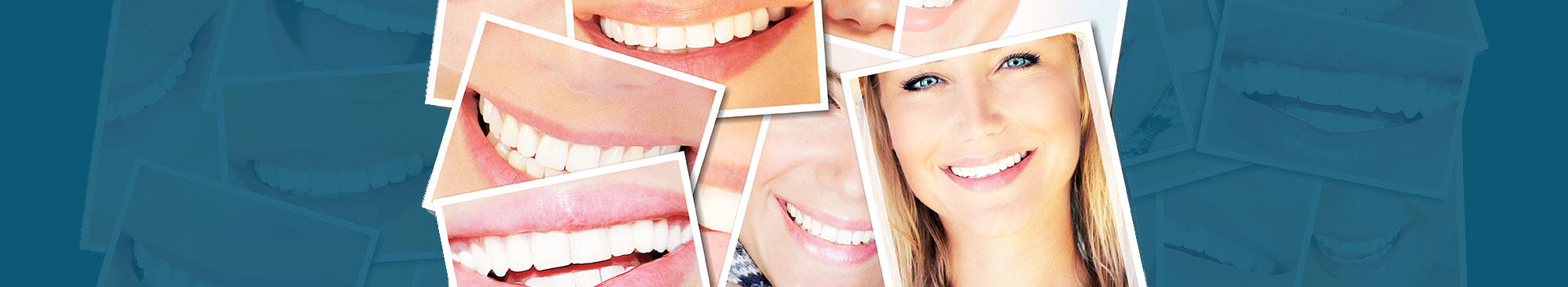 The Smiles Card - Smile More Dental